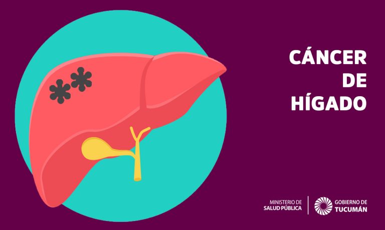 Cáncer de hígado: a quiénes afecta y cómo es su diagnóstico ...